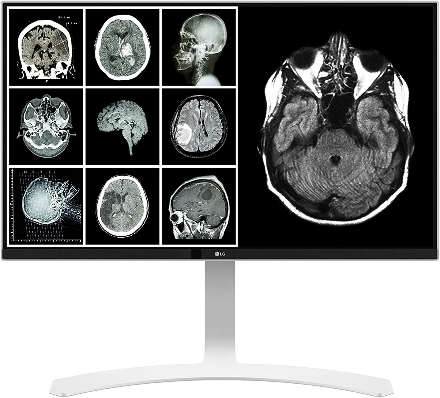 Best Monitors for X-Ray and Medical Use – Buying Guide